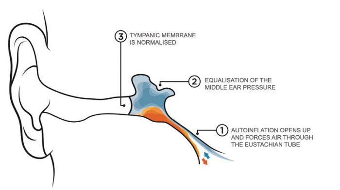 Otovent – mymuna ishoppe